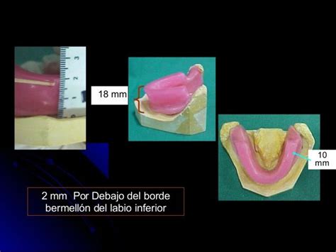 Client Challenge Materiales Dentales Base De Acrilico Rodetes