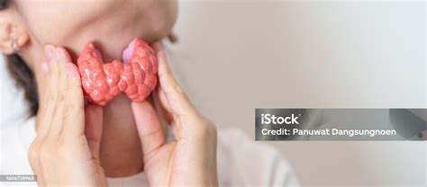 Woman Holding Human Thyroid Anatomy Model With Her Neck Hyperthyroidism Hypothyroidism Hashimoto