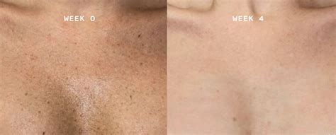 The Flasher Pro Nood