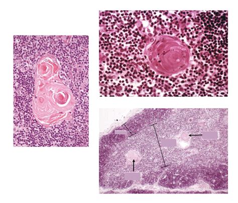 Thymic Corpusclehassalls Corpuscle Diagram Quizlet