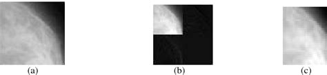 figure 1 from wavelet analysis and orthogonal moments based classification of microcalcification