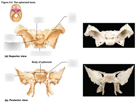 Hypophyseal Fossa Of Sphenoid Bone