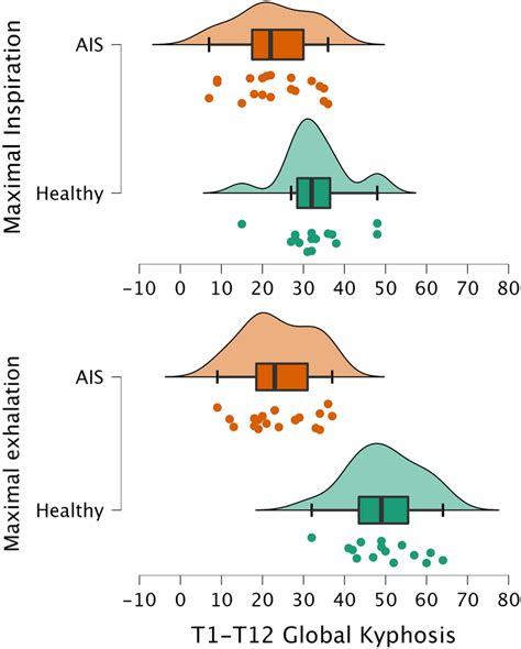 Raincloud Plots With Horizontal Display Showing Data From The Global