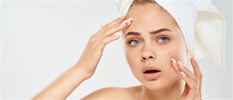 Cystic Acne Treatment