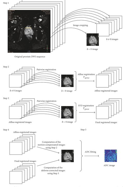 Figure 2 From Nonrigid Registration Of Prostate Diffusion Weighted Mri Semantic Scholar