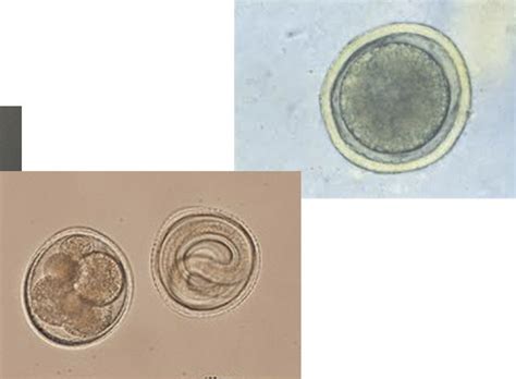 Diagnostics Midterm Lab Pract Flashcards Quizlet