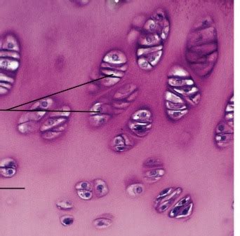 Lecture 5 Flashcards Quizlet