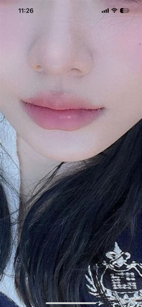 시술수술 질문 약간 입술필러 듀이 강남언니 1등 성형수술and피부시술 정보앱