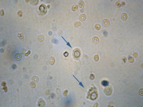 36 ideias de Sedimentos urinario educação fisica parasitologia urina