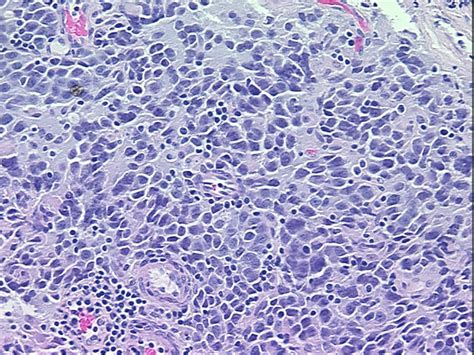 Cs805716 Tissue Ffpe Sections Testis Biotrend