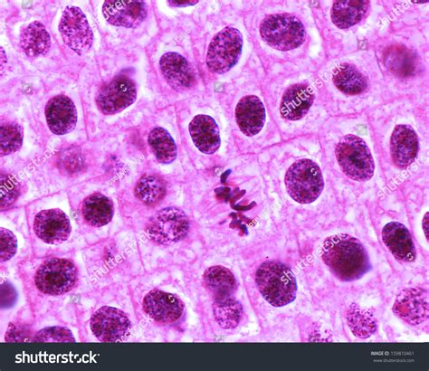 Interphase Under Microscope