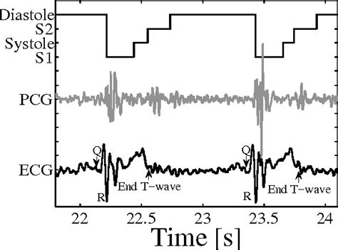 Figure 1 From Support Vector Machine Hidden Semi Markov Model Based