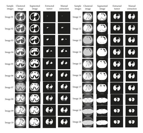 Resultant Images By The Pso Algorithm Download Scientific Diagram