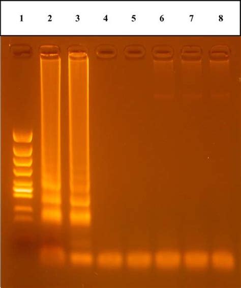 Rt Lamp Products With Different Source Of Rna Dna Template I E From Download Scientific