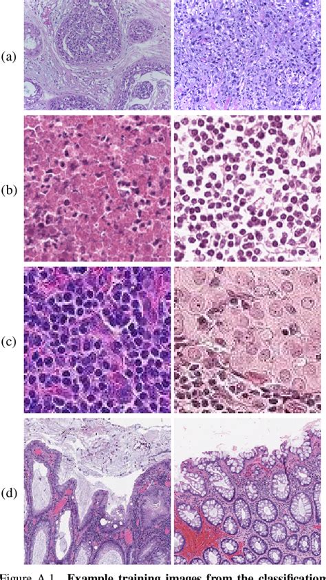 Figure A 1 From Benchmarking Self Supervised Learning On Diverse Pathology Datasets Semantic