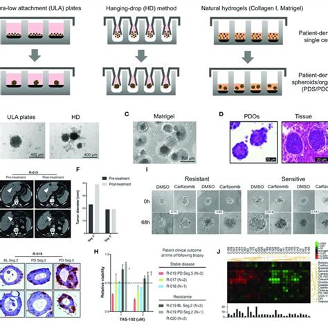 Patient Derived Organoidsspheroids Pdopds A Schematic Diagram