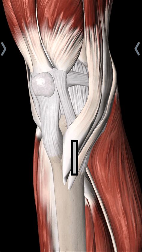 Tendinitis Pes Anserinus Anserina Pata Ganso Tendiosi