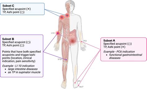 Frontiers Similarities Between Ashi Acupoints And Myofascial Trigger