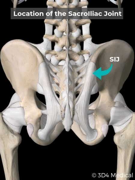 Sacroiliac Joint Dysfunction Geelong Osteopaths