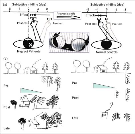 Prism Adaptation In Neglect Download Scientific Diagram