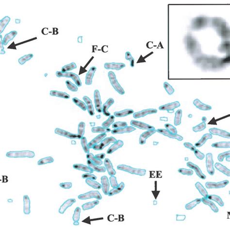 Typical Karyotypic Abnormalities Obtained After 48 H Of Wt Myc Protein