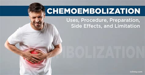 What Is Chemoembolization