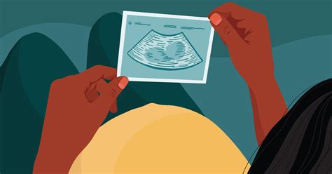 20 Babes One Girl Sex Sex Pictures Pass