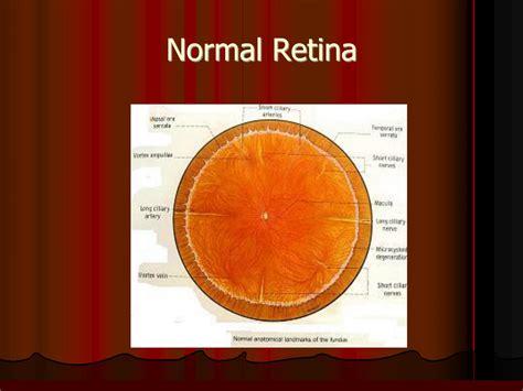 Solution Retinal Detachment Normal Retina Classification Types