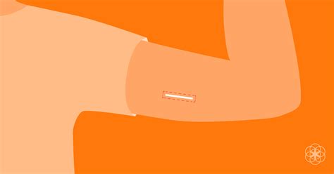 Birth Control Implant Reviews And What Its Like