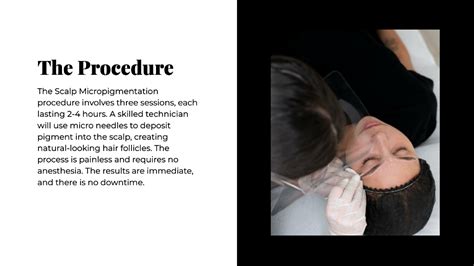 Ppt Scalp Micropigmentation Understand The Procedure And Why It Is
