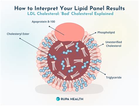 How To Interpret Your Lipid Panel Results