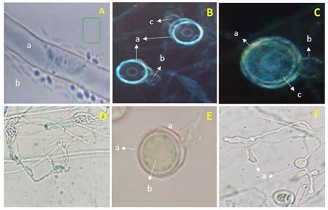 Characterization And Pathogenicity Of A Pythium Aphanidermatum Isolate Causing ‘damping Off In