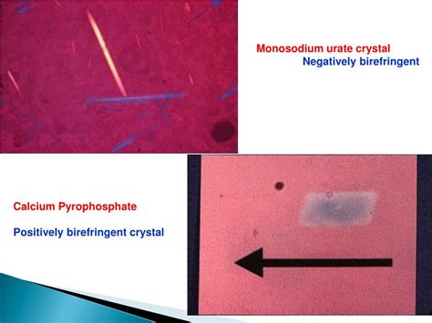 Ppt Joint Pathology Powerpoint Presentation Free Download Id3999897