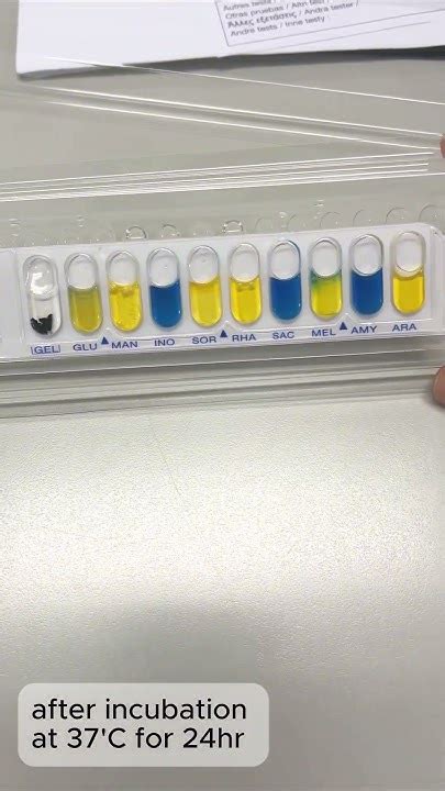 Api20e Test Kit For Microbial Identification Microorganisms Api20e Testkit Microbiology