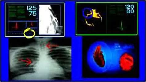 RGB Spectrum Introduces Annotator Option For QuadView HDx MultiViewer UST