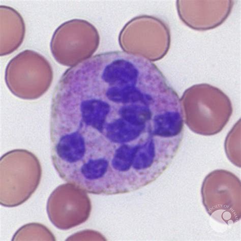 Segmented Neutrophils