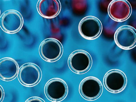 Gene Vs Genome Definition Function And Impact