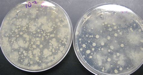 Dvc Microbiology 146 Fall 11 Gard Lab 41 Standard Plate Count Of