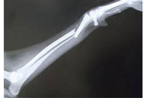 Diagnoses Cmdbs And Broken Legs Blazent It Data Intelligence