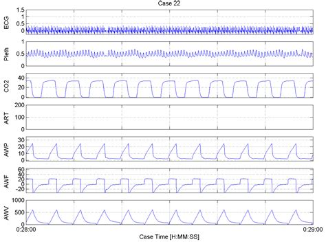 Case Waveform Plots Second Plots