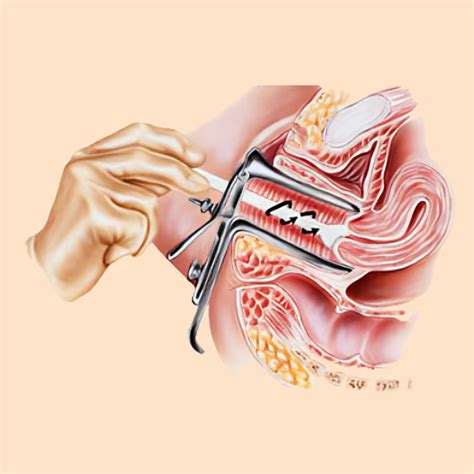 Pap Smear Results What You Need To Know For Better Health