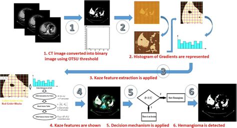 liver hemangioma detection methodology download scientific diagram