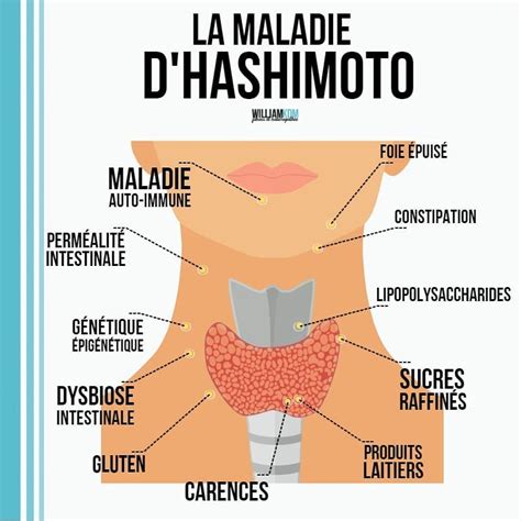 La Thyroïde Et Ses Mystères Sophie Pihan Naturopathe Et Massages Vannes