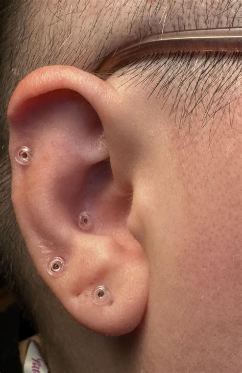 Mri Glass Retainer Pictures Rpiercing