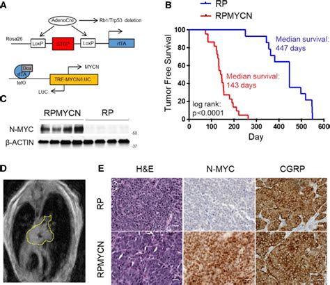 Mycn Overexpression Promotes Sclc In Mouse Models A Schematic Of
