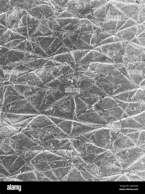 Scanning Electron Micrograph Sem Of Photocomposite E Coli On The Surface Of Human Skin