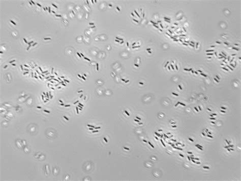 Lactobacillus Fermentum Viticulture And Enology