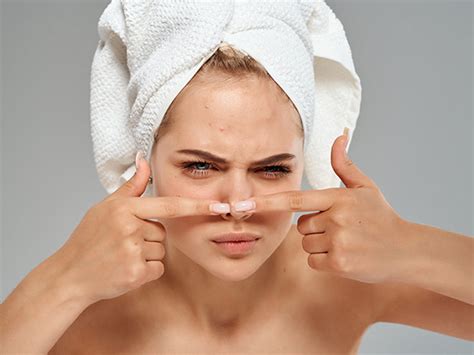 How To Get Rid Of Pimples On The Nose Skinkraft