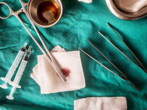 Minor Surgical Procedures Definition Types And Importance