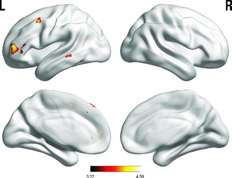 Whole Brain Correlation Analysis For Na Reactivity During Uninstructed